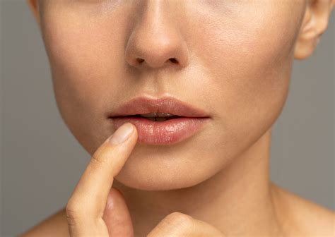 Litteken Lip Verminderen Praktische Tips Voor Een Sneller Herstel