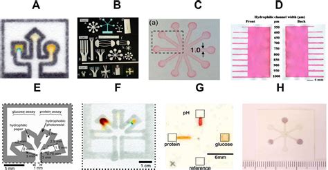 Frontiers Advancements And Challenges In Microfluidic Paper Based