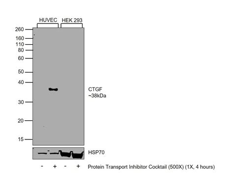 Ctgf Antibody Ma5 26817