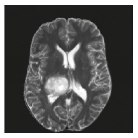 Structure Of The Dilated Convolution Block Download Scientific Diagram