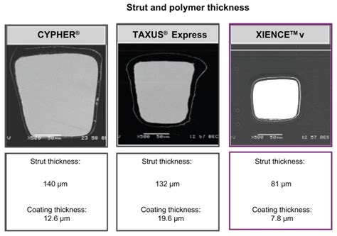 Photomicrographs Of Strut And Polymer Thickness Of 1st And 2nd Download Scientific Diagram