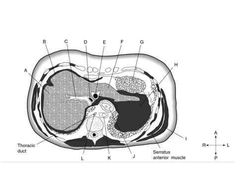 Transverse Section Of The Abdomen At T9 Vertebrae Quiz