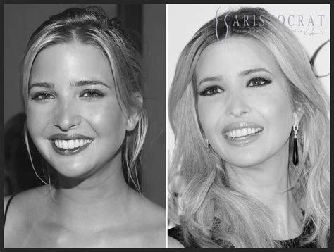 Best Celebrity Before And After
