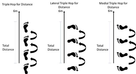 Clinical Commentary A Criteria Based Testing Protocol For Return To