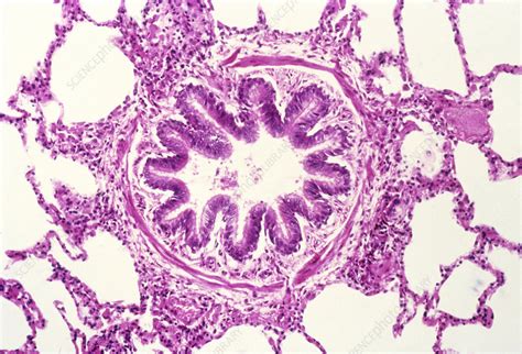 Lm Of A Cross Section Of A Bronchiole And Alveoli Stock Image P590 0039 Science Photo Library