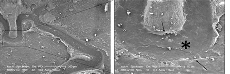 Microscopy Of An Explanted Rat Aorta Ruptured Endothelial Region
