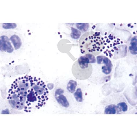 Série Bactéries Pathogènes Kategorie Conatex