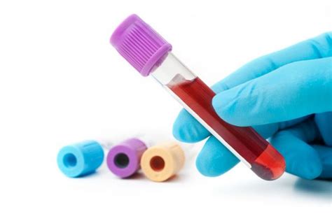 Testing Thyroid Uk