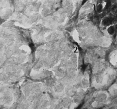 Calbindin D 28k Immunoreactivity In Rat Adrenal Medulla Chromaffin Download Scientific Diagram