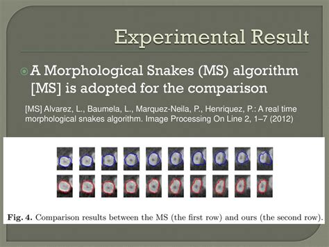 Tooth Segmentation From Cone Beam Computed Tomography Images Using The Identiﬁed Root Canal And