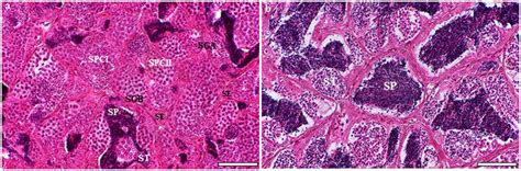 Light Microscopic Analysis Of Hande Stained Sections Of Testes At