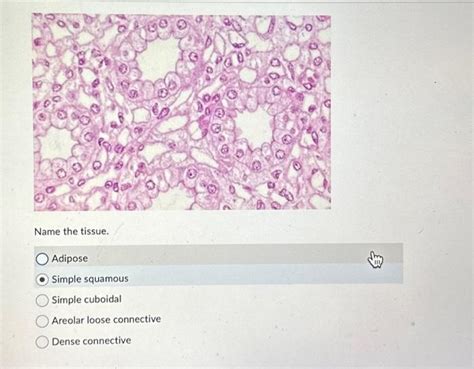Solved Name The Tissue Adipose Simple Squamous Simple