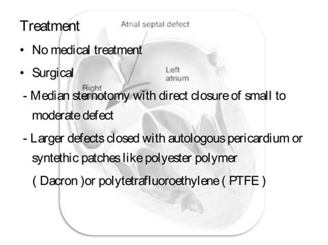 Atrial Septal Defect Ppt Heart And Cardiovascular Diseases