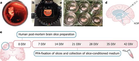 Human Post Mortem Organotypic Brain Slice Cultures A Tool To Study