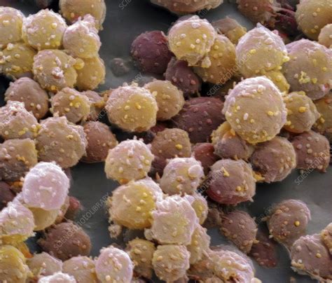 Archaea Sem Stock Image C0608432 Science Photo Library