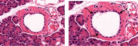 Estrutura Celular Epitelial Resumo De Tecido Epitelial