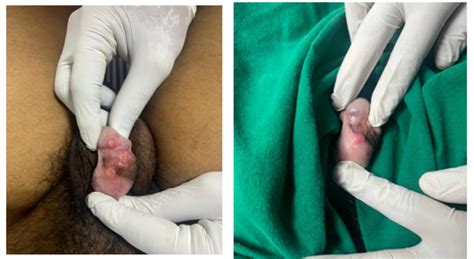 Dermatology Photo Quiz 2