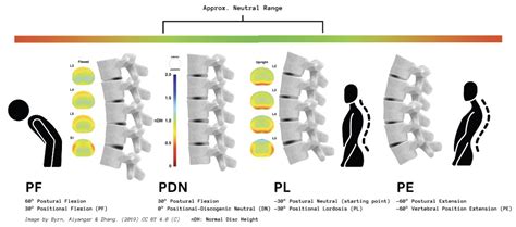 Postural Vs Positional Neutral Addressing The Complexities Of