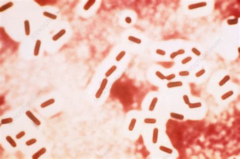 Clostridium Perfringens Gram Stain Enteric Clostridial Infections