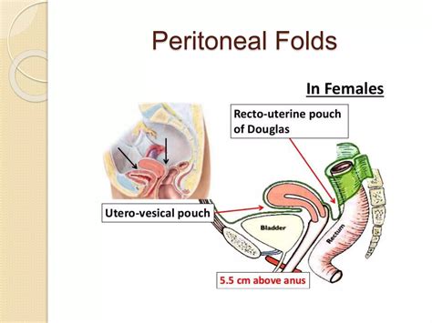 Supports Of Uterus Pptx Supports Of Uterus Pptx