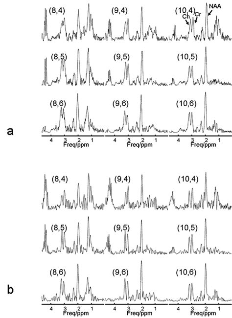 Spectral Resolution Amelioration By Deconvolution Spread In Mr