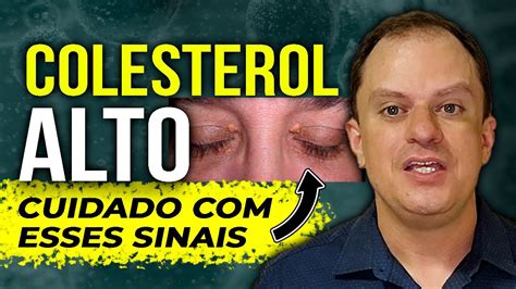 🚨colesterol Alto Causas E Sintomas Youtube