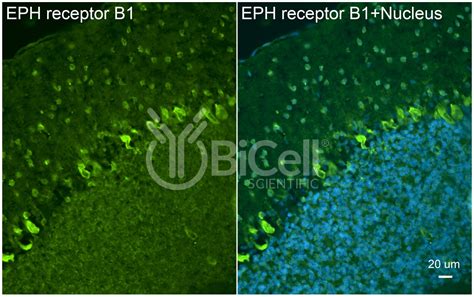 EPH receptor B1 (EPHB1) antibody - BiCell Scientific®