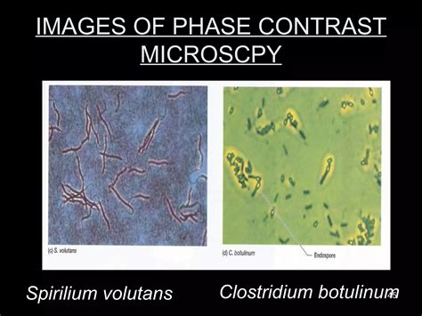 Microscopy Ppt