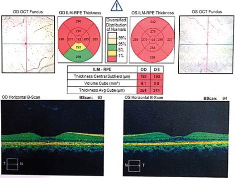 Stellate Iris Williams