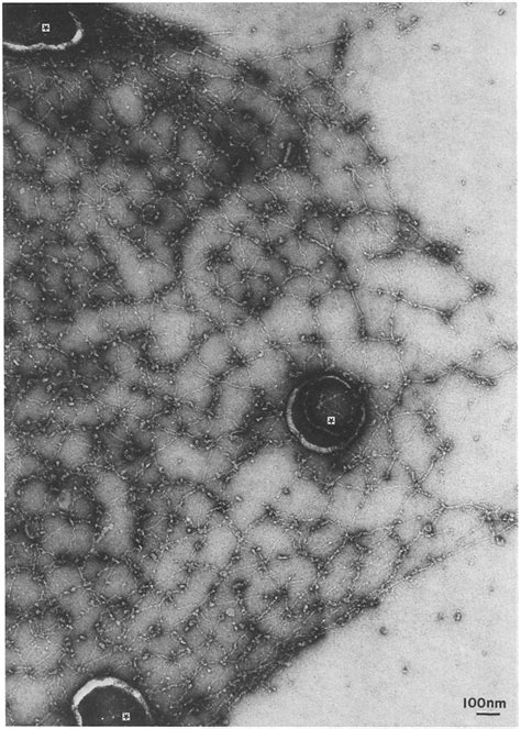 Spread Membrane Skeleton A Large Area Of The Spread Skeleton At High