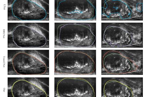 Image Segmentation Medical Imaging Research For Translational Healthcare With Artificial