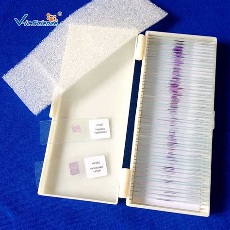 Microscope Slide Of Pathology Disease Educational Slides
