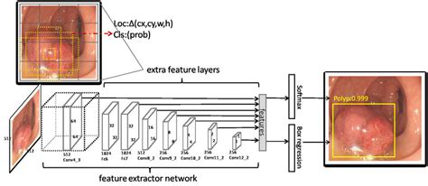 proposed ssd polyp detection framework architecture feature