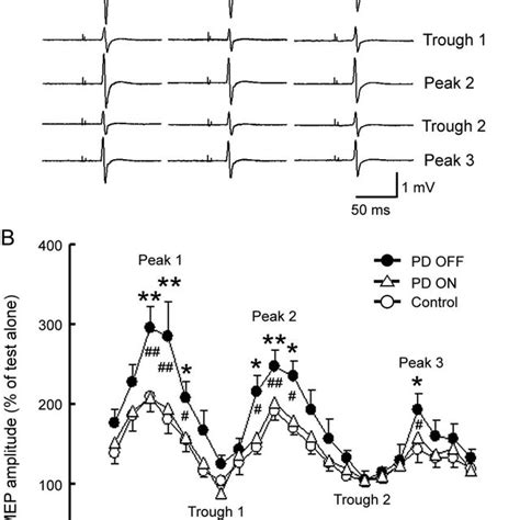 Short Interval Intracortical Inhibition And Intracortical Facilitation Download Scientific