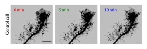 Use Of Paraformaldehyde Pfa Fixed Cells To Reveal Nonbiological Download Scientific Diagram