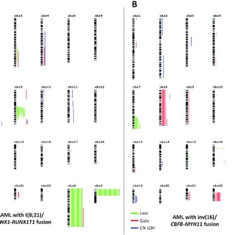 Karyograms Of Detected Snp Array Lesions By Genetic Subtype Each