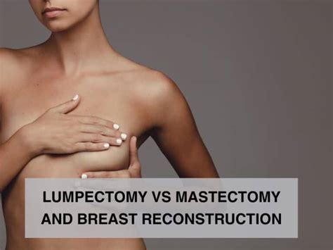 Lumpectomy Vs Mastectomy And Breast Reconstruction