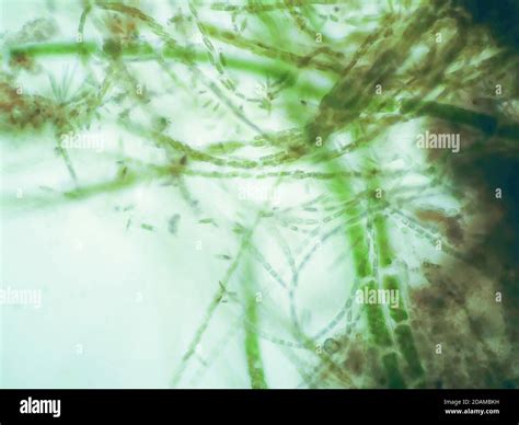 Filamentous Algae Light Micrograph Filamentous Algae Are Single Algae