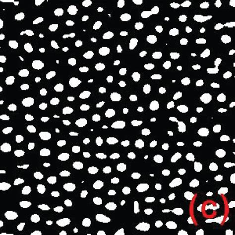 Representative Example Of Postprocessing A Ao Slo Image B Bias