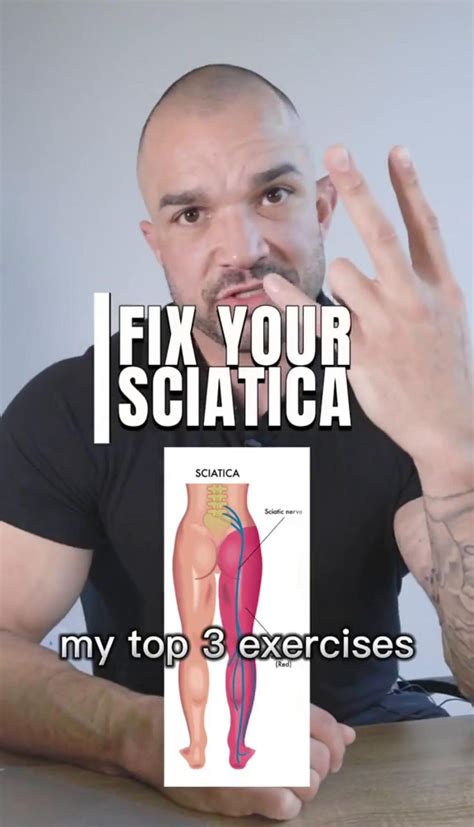 Dealing With Sciatica Is Truly Dreadful In 2024 Sciatica Sciatica
