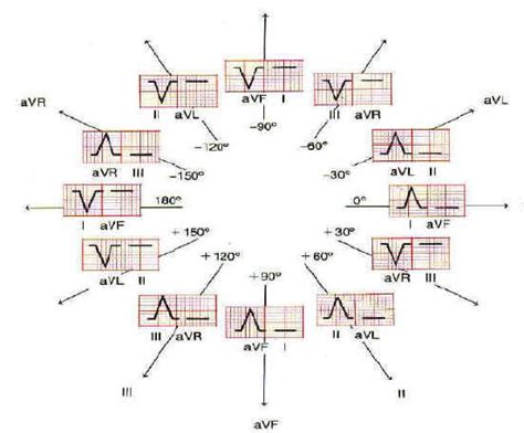 Ecg Educator Blog Artofit