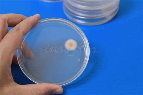 Colonies Of Bacteria Growth On Agar Plate Medium In Laboratory Stock