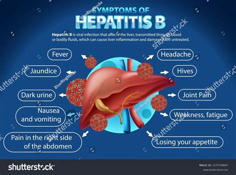 Symptoms Hepatitis B Infographic Illustration Stock Vector Royalty