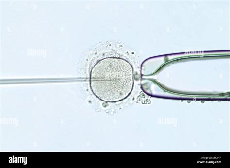 Sperm Injection Hi Res Stock Photography And Images Alamy