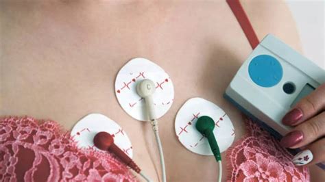 Worlds First Leadless Pacemaker Woman With Complex Congenital Heart