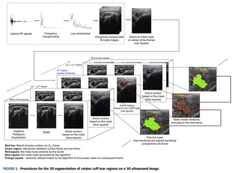 Wide Field 3d Ultrasound Imaging Platform With A Semi Automatic 3d