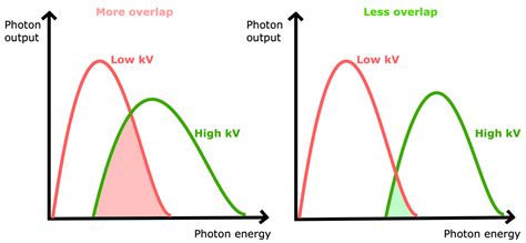 Pros And Cons Of Dual Energy Ct Systems “one Does Not Fit All”