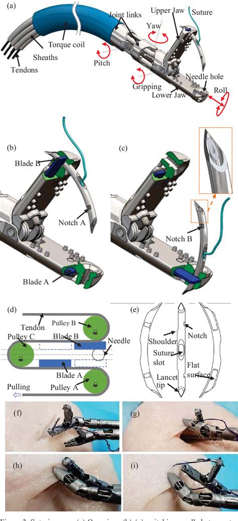 Figure 1 From A Novel Robotic Suturing System For Flexible Endoscopic