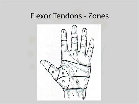 Ppt Flexor Tendons Zones Powerpoint Presentation Free Download
