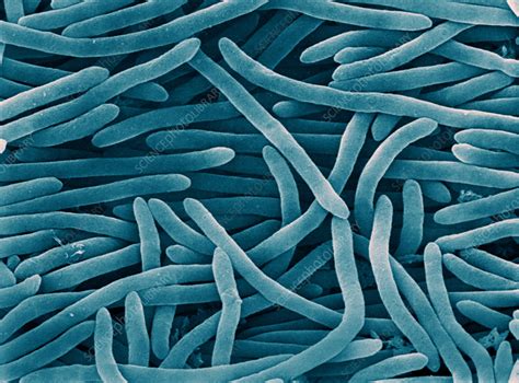 Heliobacteria Sem Stock Image C056 2280 Science Photo Library